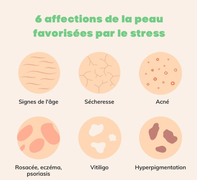 Le stress et les conséquences sur votre peau . – Naturopathe ...